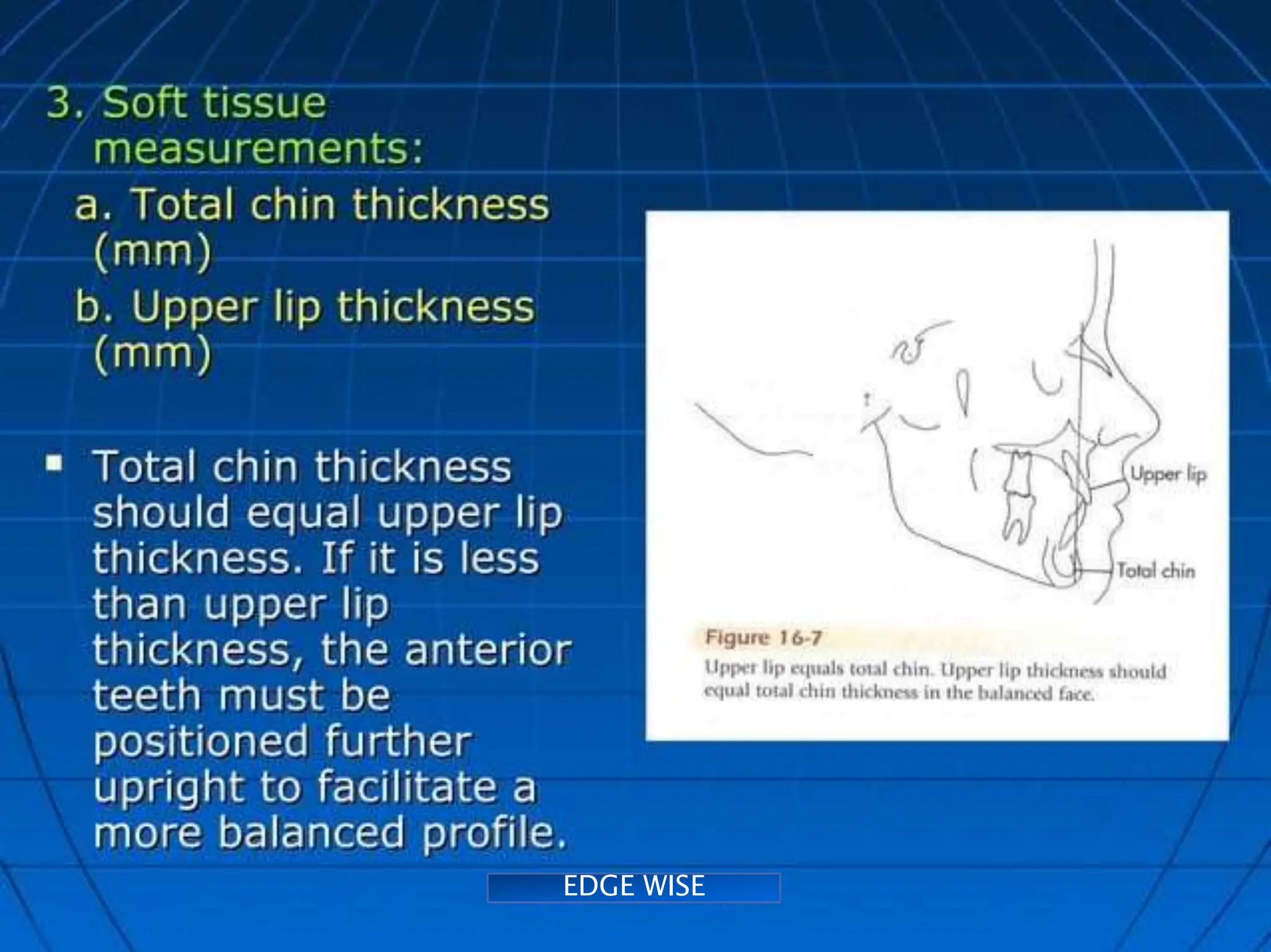 TWEED MERRYFIELD EDGEWISE _EDITED_V2.pptx