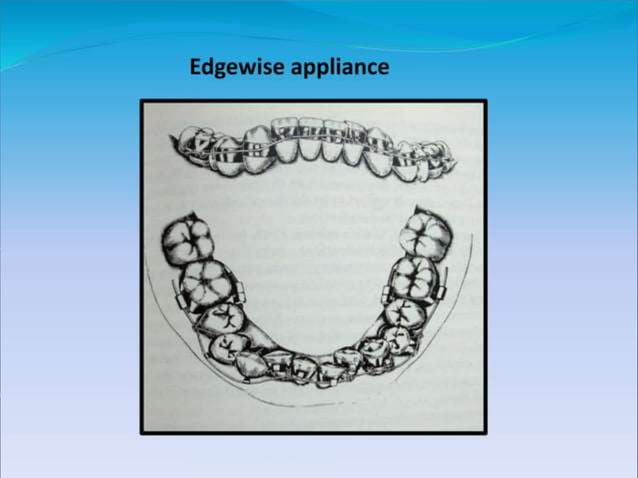TWEED MERRYFIELD EDGEWISE _EDITED_V2.pptx | Dental Health | Diseases ...