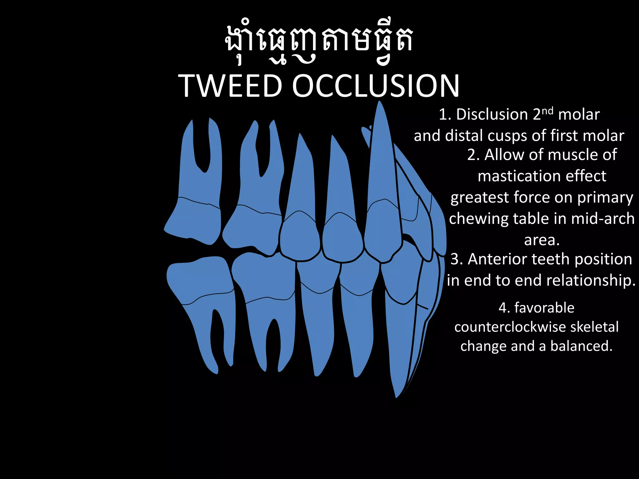 Tweed occlusion | PPTX