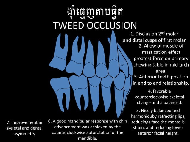 Tweed occlusion | PPT
