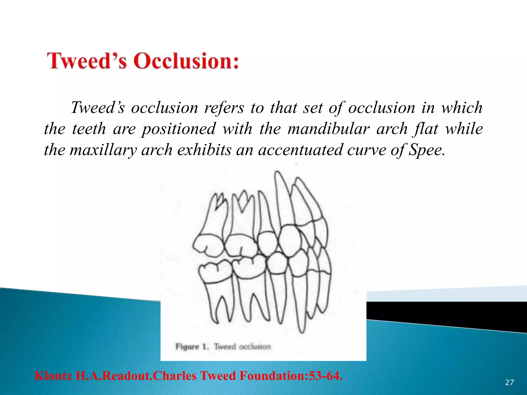 Tweed's Occlusion | PPTX