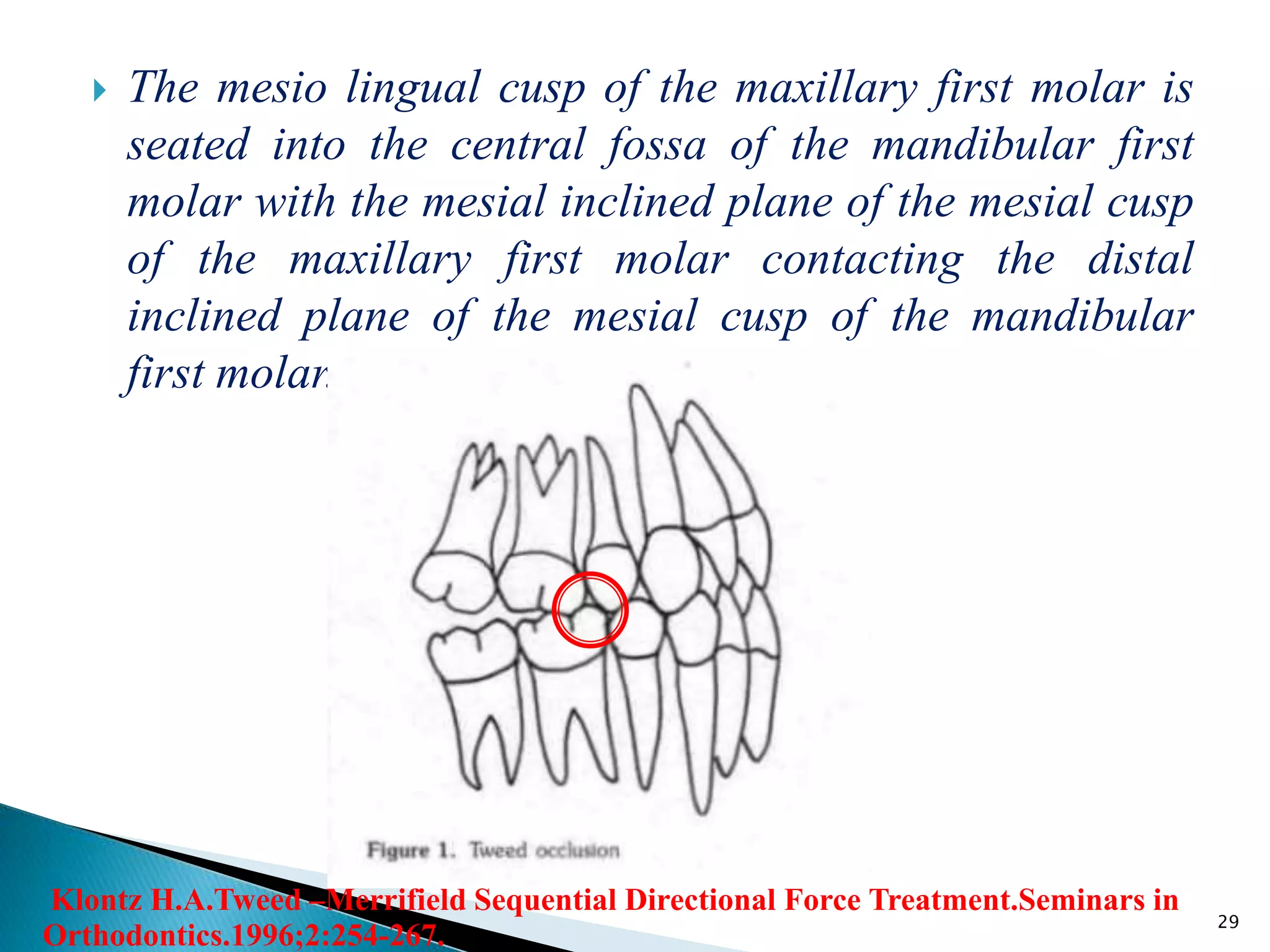 Tweed's Occlusion | PPTX