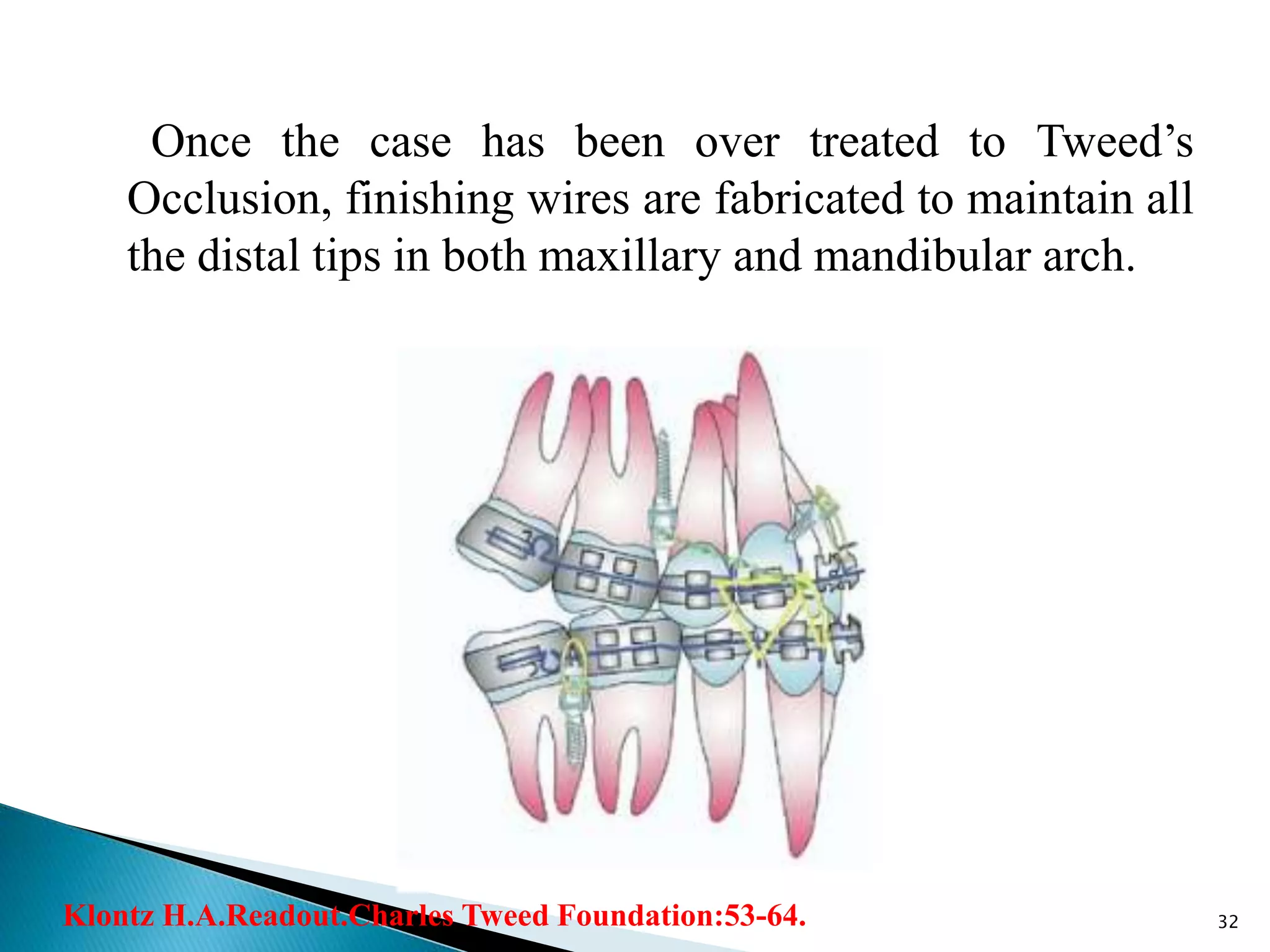 Tweed's Occlusion | PPTX