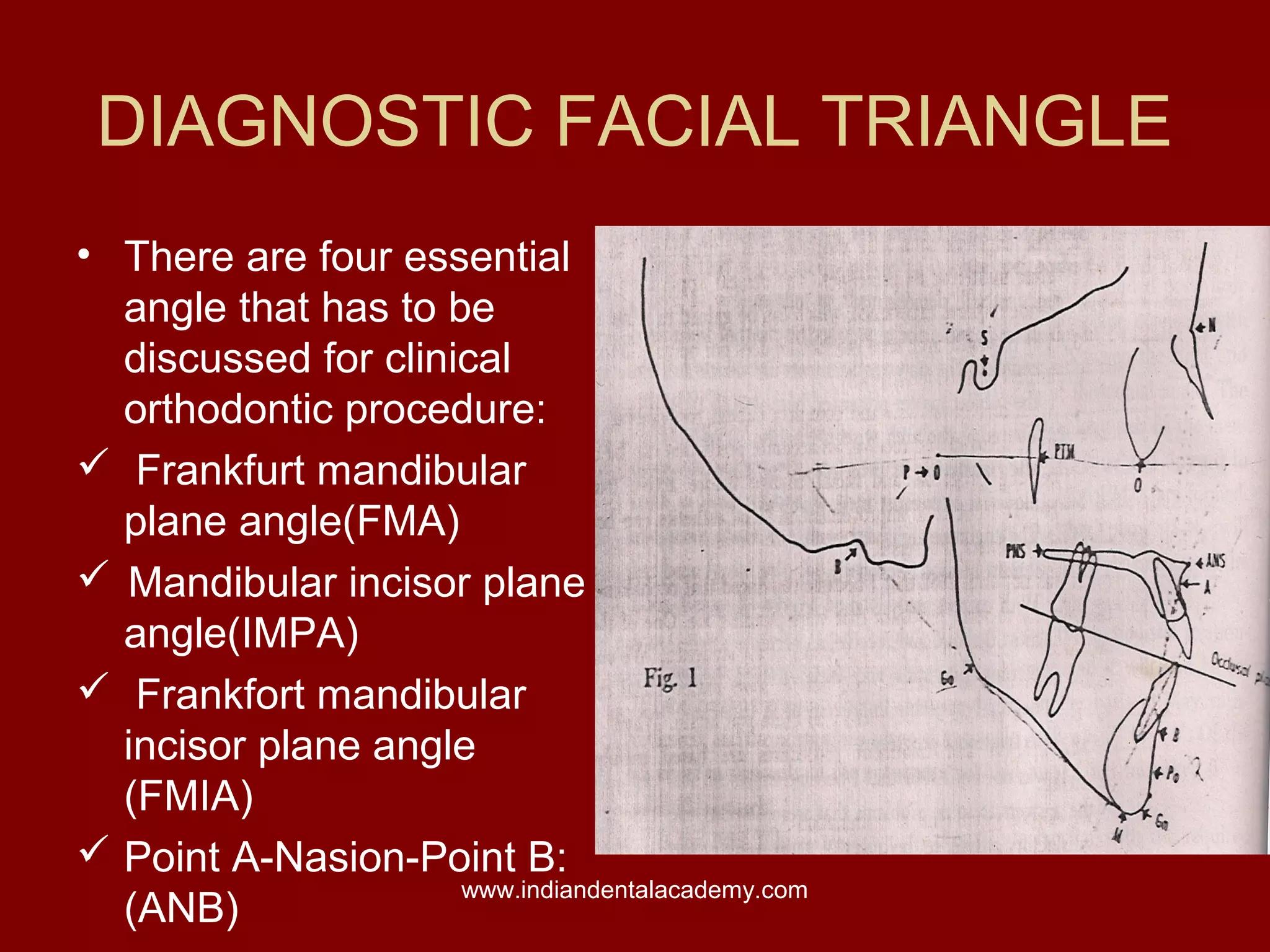 Tweeds analysis & wits appraisal / dental crown & bridge courses | PPT
