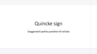 Twelve eponymous signs of aortic regurgitation | PPTX