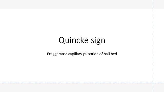Twelve eponymous signs of aortic regurgitation | PPTX