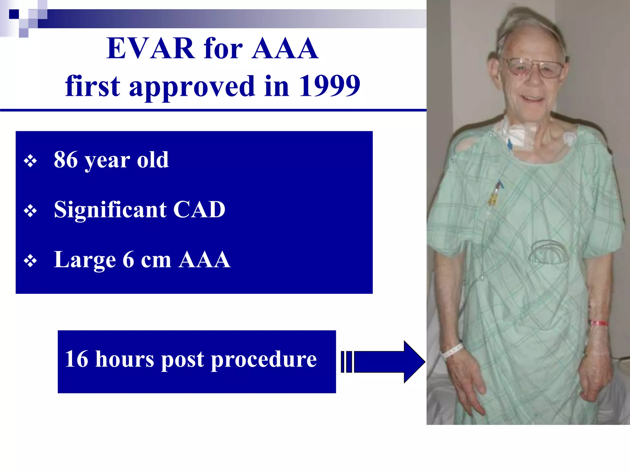 Twenty years of evar in the us the procedure that changed a specialty ...
