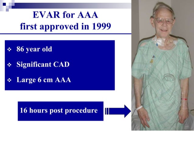 Twenty years of evar in the us the procedure that changed a specialty | PPT