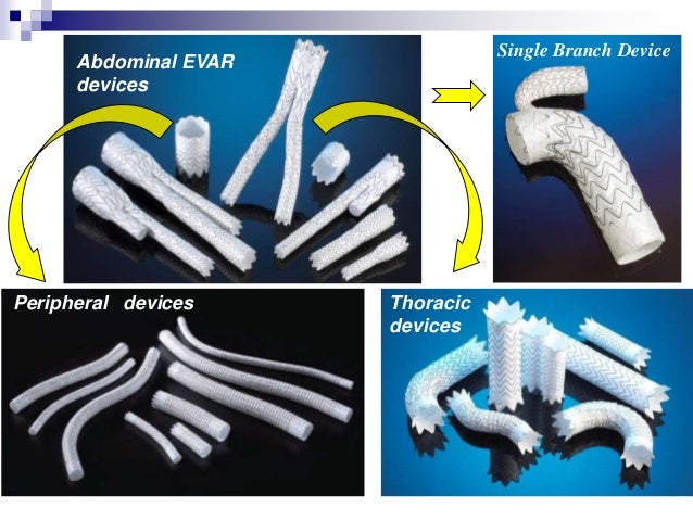 Twenty years of evar in the us the procedure that changed a specialty