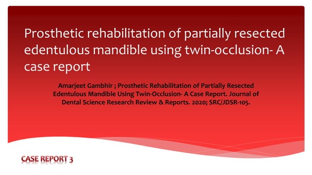 Twin occlusion prosthesis in a class 3 | PPTX | Oral care | Personal Care