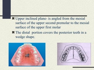 Twin block appliance. Dr. Ajay | PPT