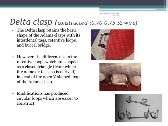 Twin block /certified fixed orthodontic courses by Indian dental acad…