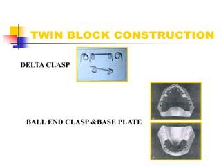 Twin Block | PPT