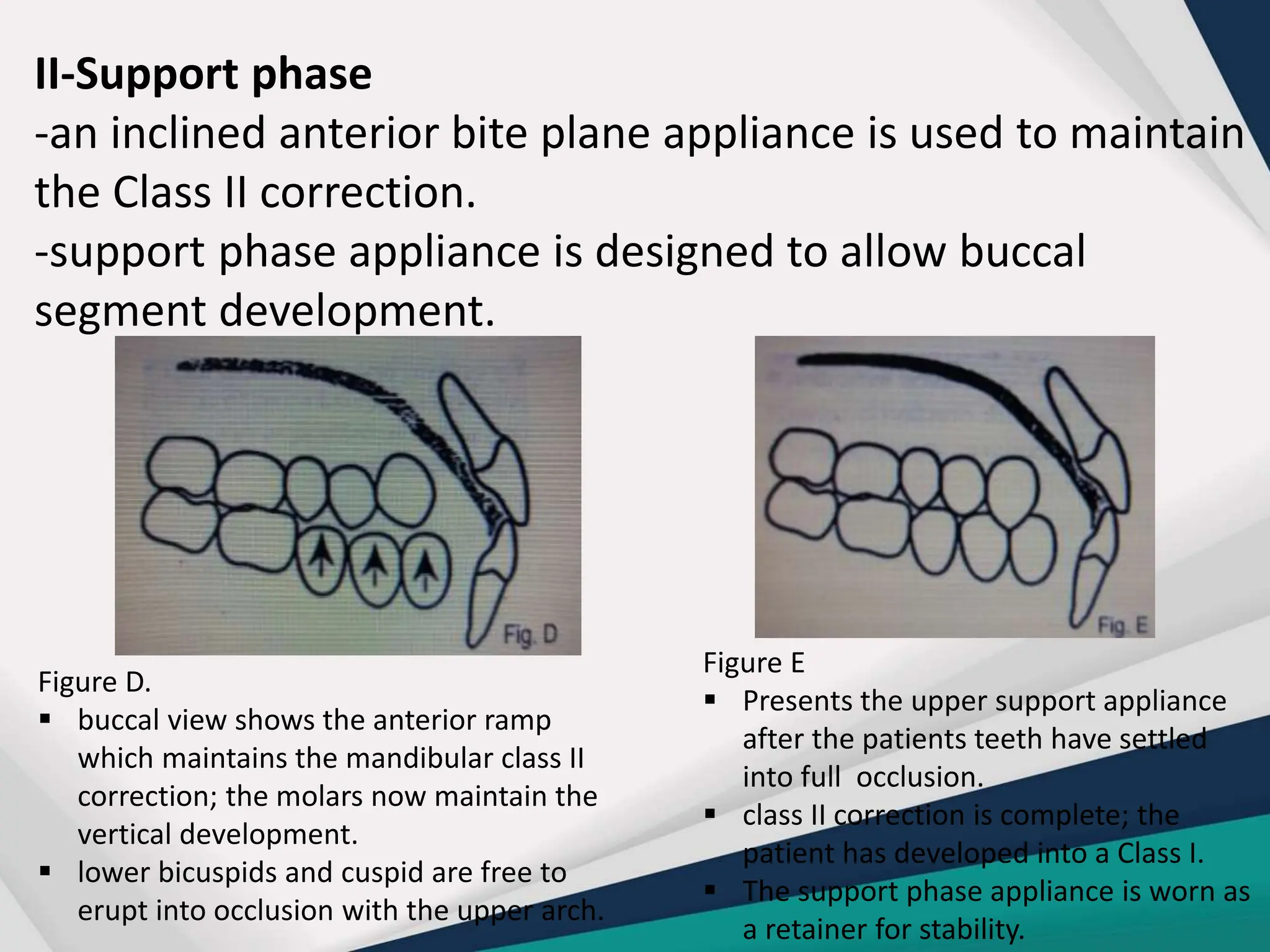 Twin Block appliance in orthodontics .pptx