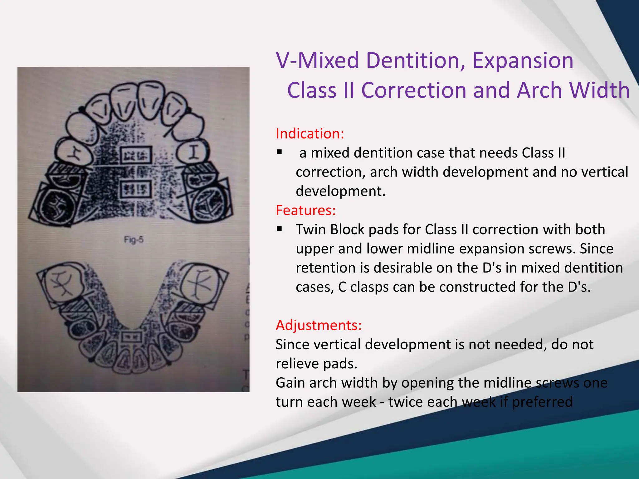 Twin Block appliance in orthodontics .pptx