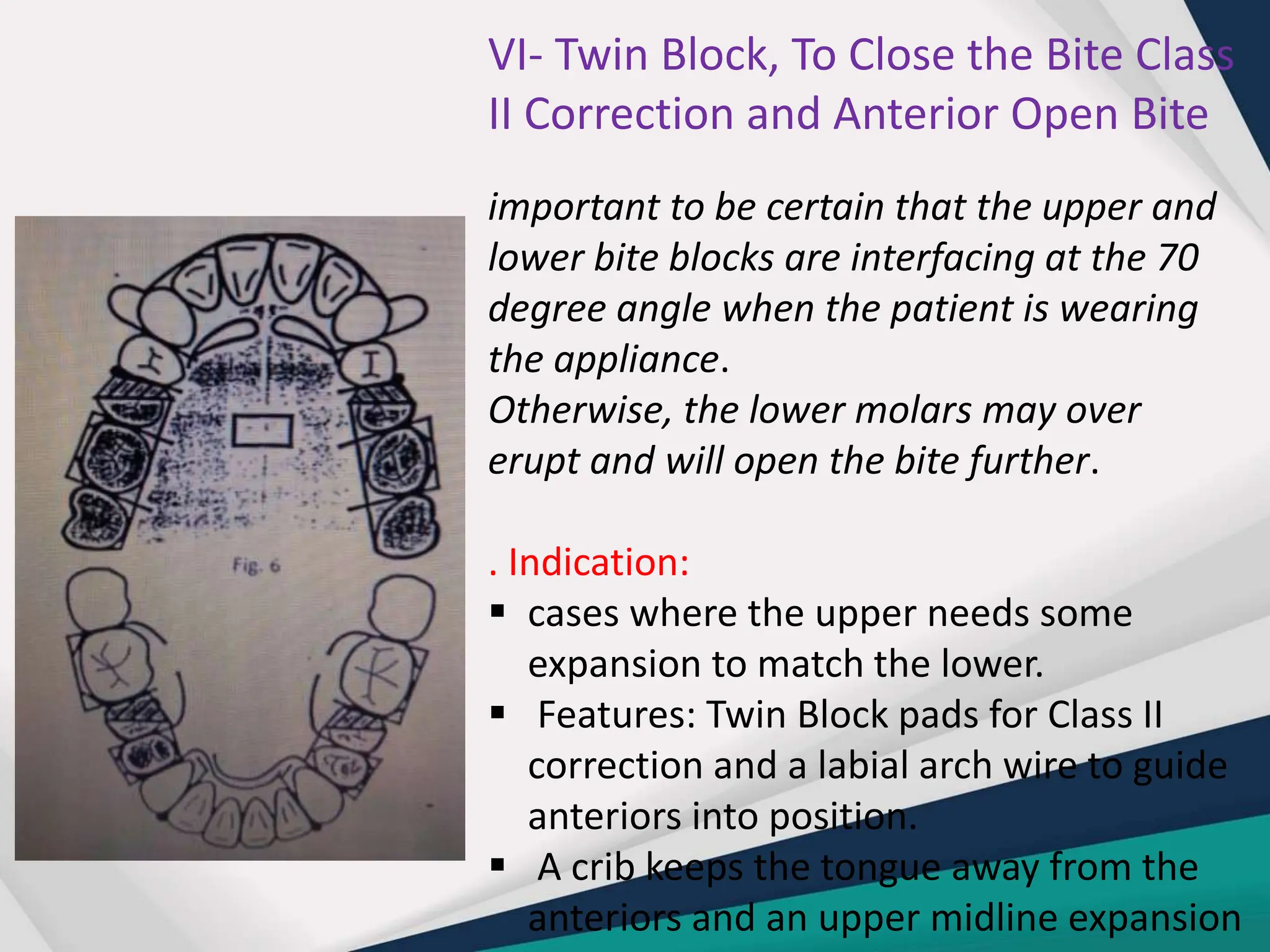 Twin Block appliance in orthodontics .pptx