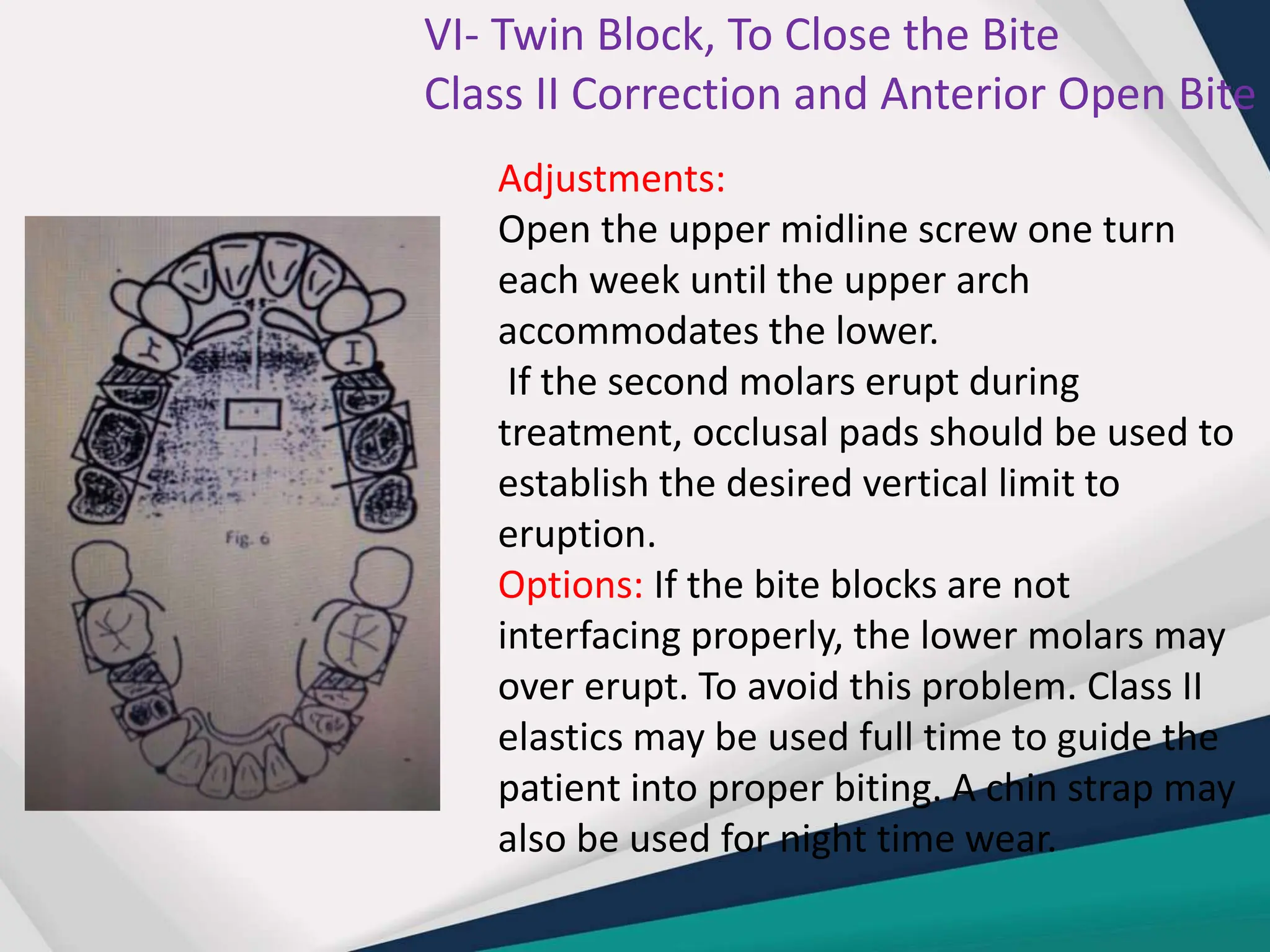 Twin Block appliance in orthodontics .pptx