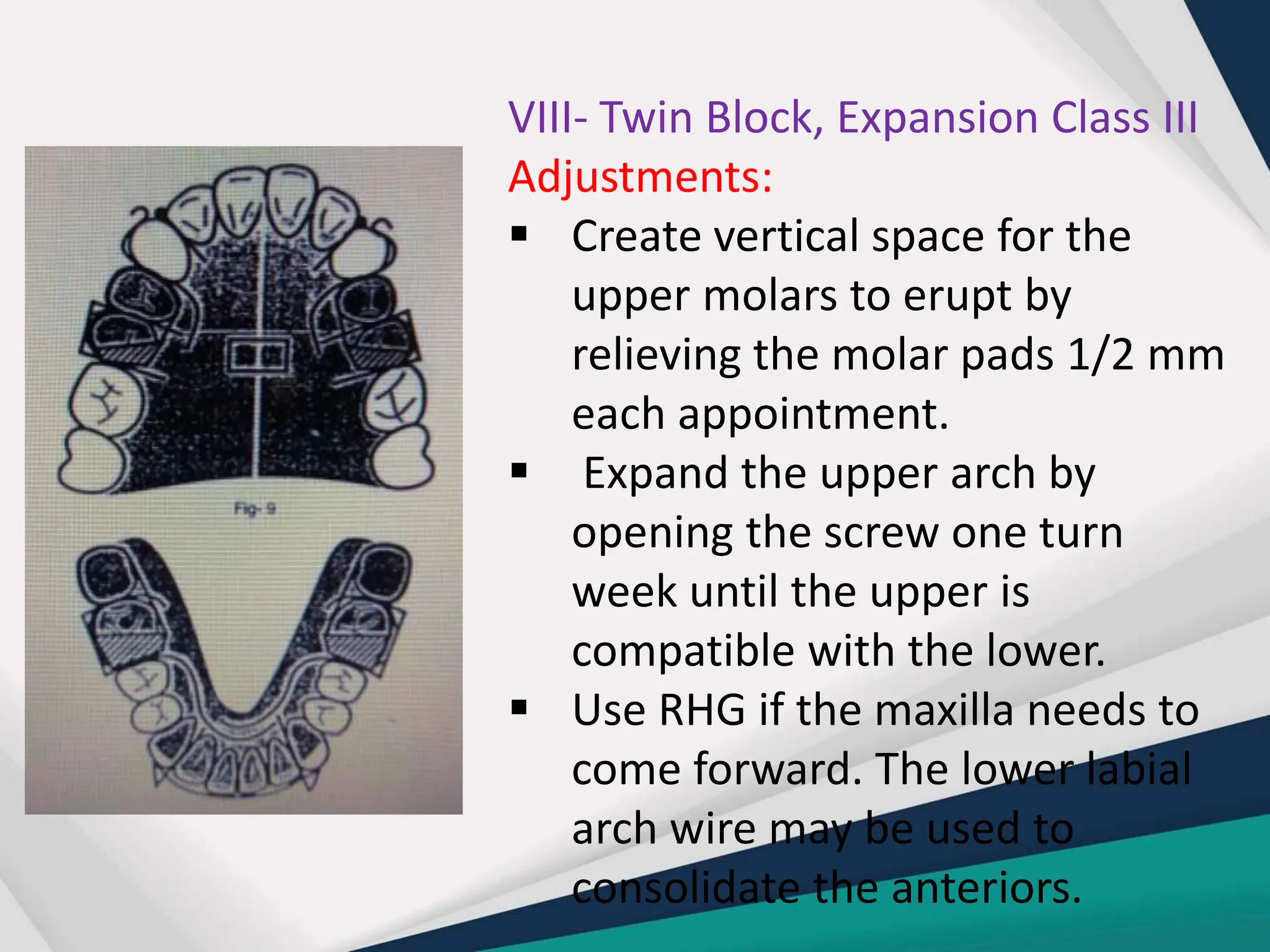 Twin Block appliance in orthodontics .pptx