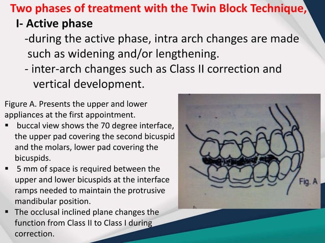 Twin Block appliance in orthodontics .pptx | Dental Health | Diseases ...