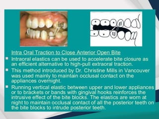 Twin Block appliance in orthodontics .pptx