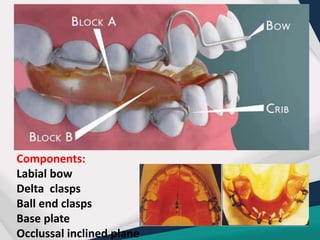 Twin Block appliance in orthodontics .pptx