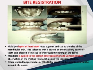 Twin Block appliance in orthodontics .pptx