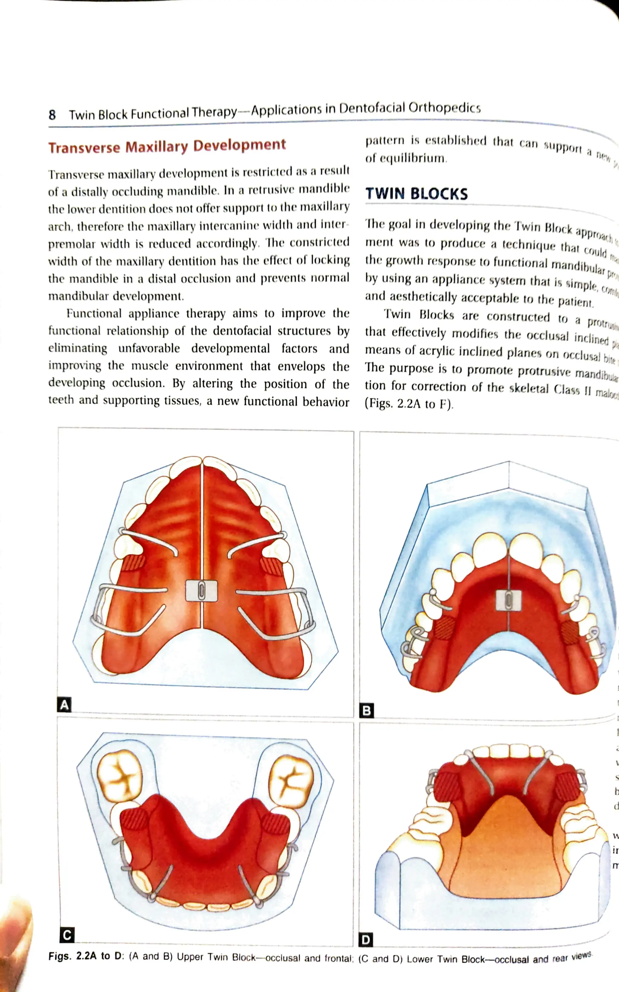Twin block myofunctional appliances by William J Clark | PDF