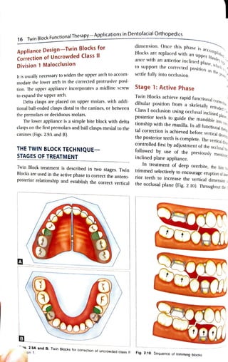 Twin block myofunctional appliances by William J Clark | PDF
