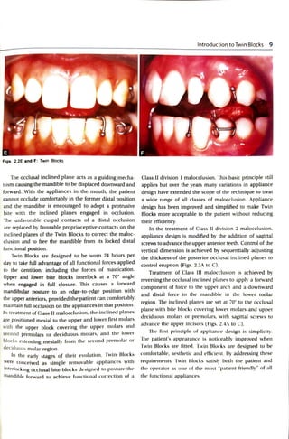 Twin block myofunctional appliances by William J Clark | PDF