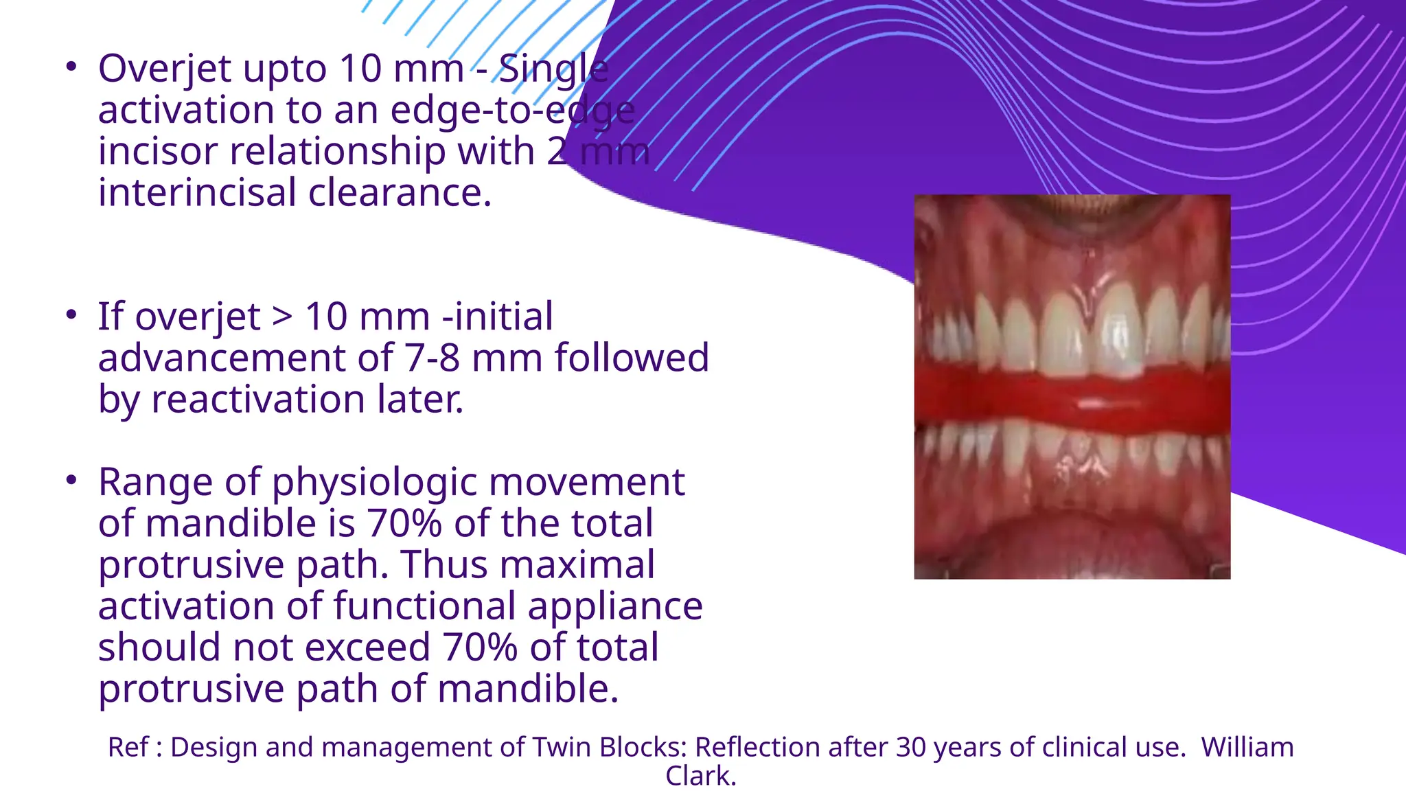 TWIN BLOCK APPLIANCE -A FUNCTIONAL APPLIANCE | PPTX
