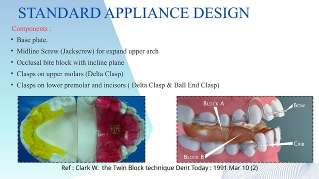 TWIN BLOCK APPLIANCE -A FUNCTIONAL APPLIANCE | PPTX