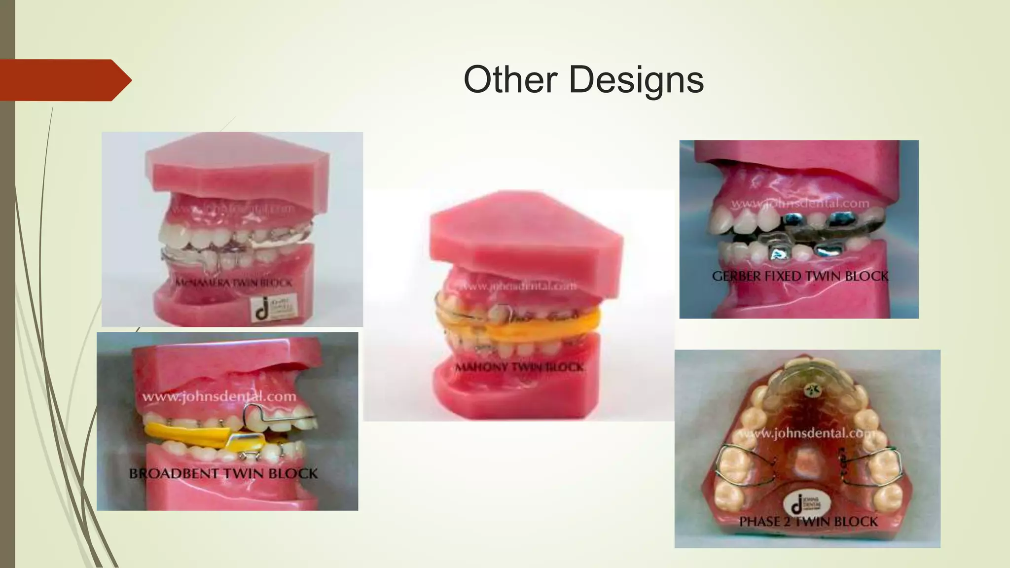 Twin Block Appliance | PPTX