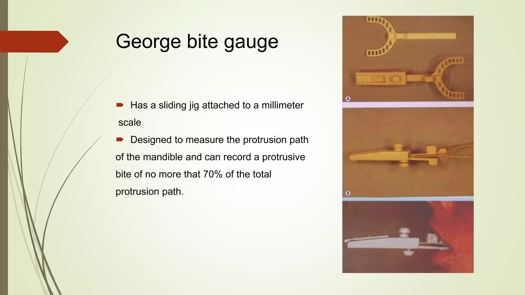 Twin Block Appliance | PPTX