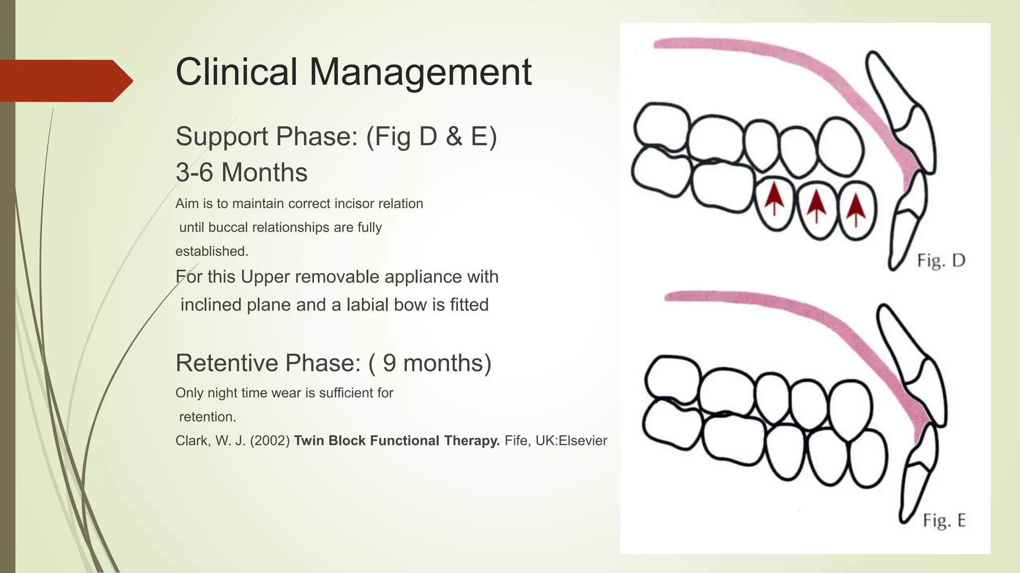 Twin Block Appliance | PPTX