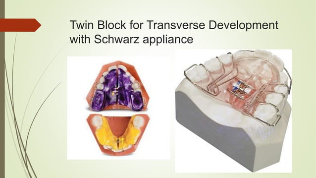 Twin Block Appliance | PPTX