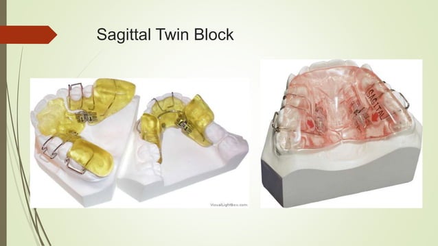 Twin Block Appliance | PPTX