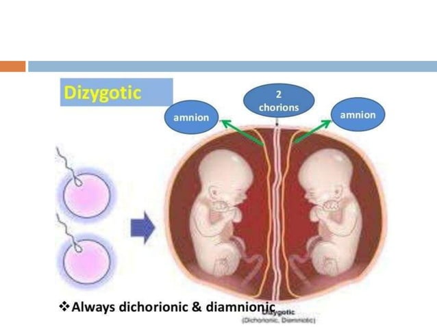 Twinning By Dr. Rabia Inam Gandapore.pptx