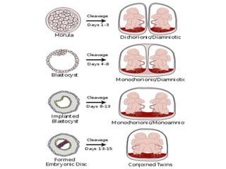 Stages Of Twin Pregnancy Week By Week