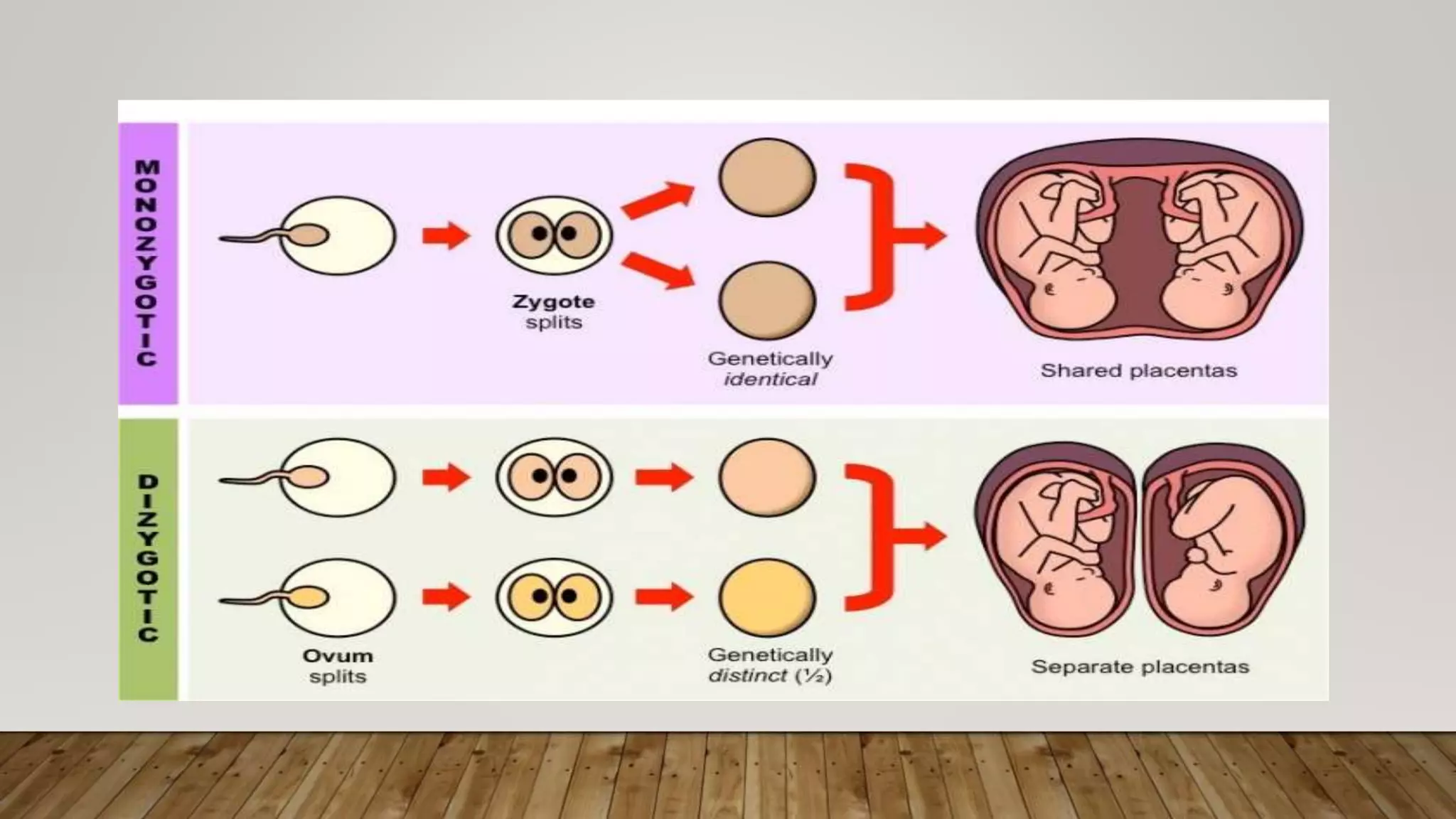 TWIN PREGNANCY | PPTX