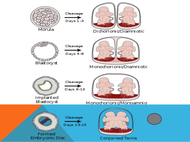 Twin pregnancy update hospital segamat