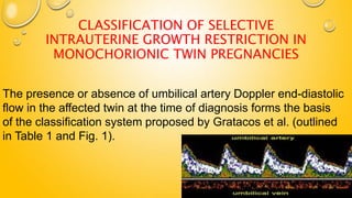 Twin pregnancy complicated by selective growth copy - copy (2) - copy | PPT