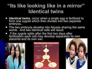 Twins - how can this be? | PPT