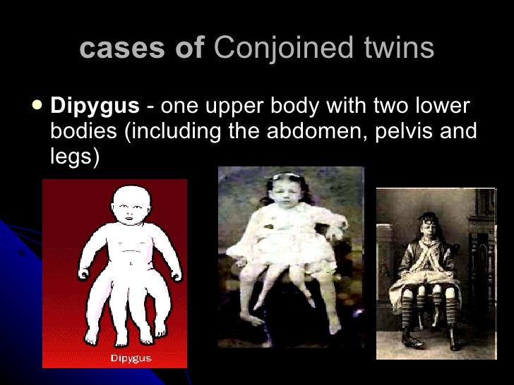 Twins - how can this be?