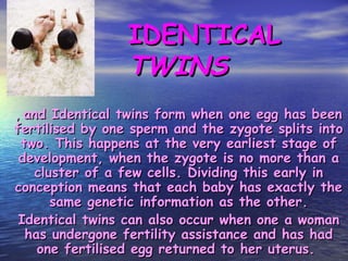 Twins | PPT