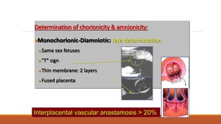 multiple gestations | PPT