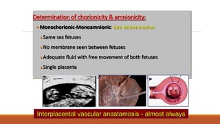 multiple gestations | PPT