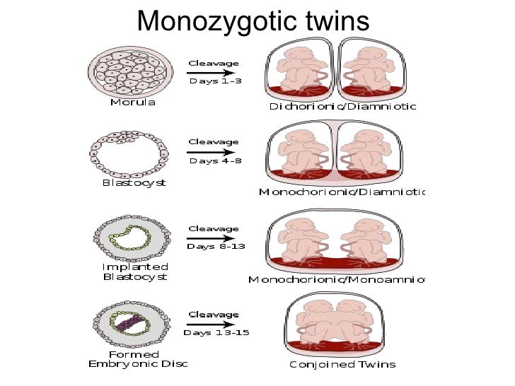 Twins clinical management 2012