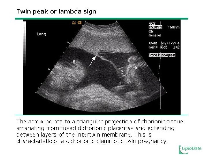 Twins clinical management 2012