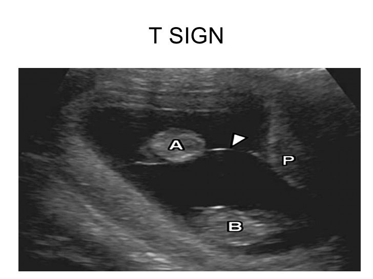 Twins clinical management 2012