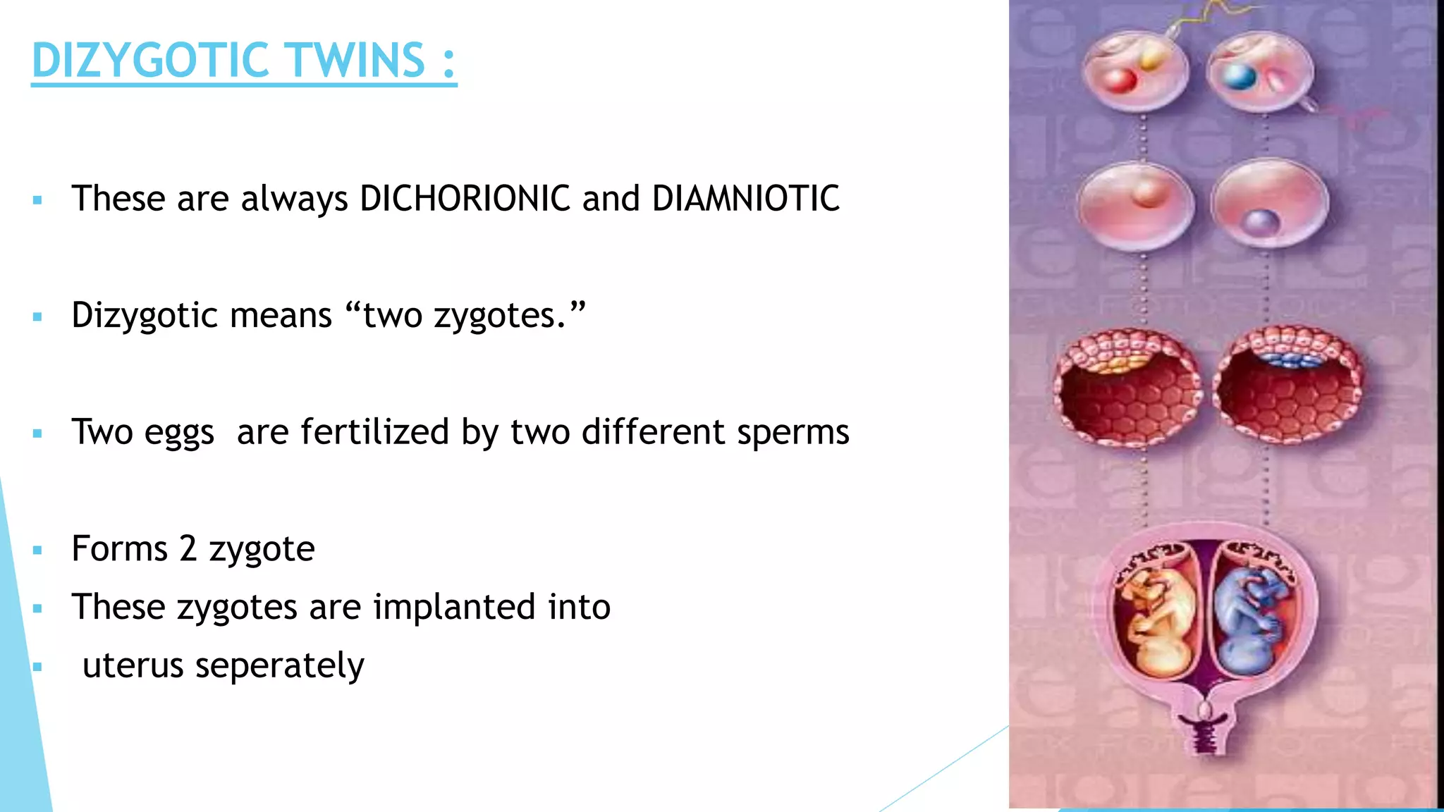 Twins (embryology) | PPTX